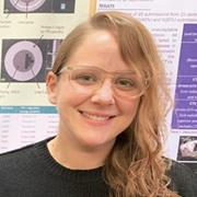 Amanda Webster | About | University College London